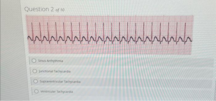 Question 1 of 10 Sinus Rhythm with PVCs Normal Sinus | Chegg.com