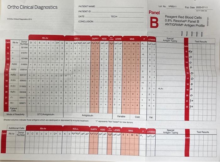 identify the red cell antigens after rolling out ? | Chegg.com