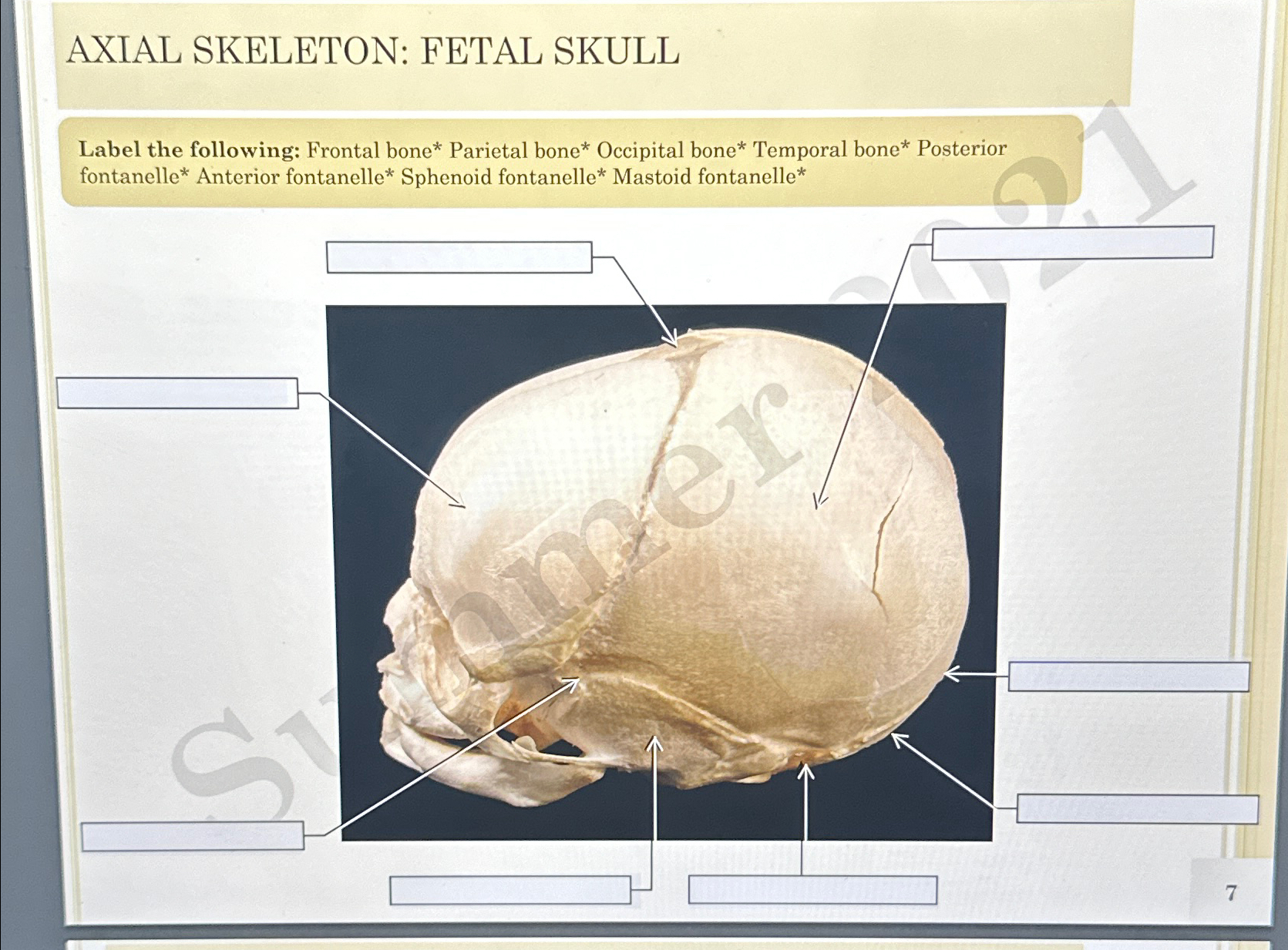Solved AXIAL SKELETON: FETAL SKULLLabel the following: | Chegg.com