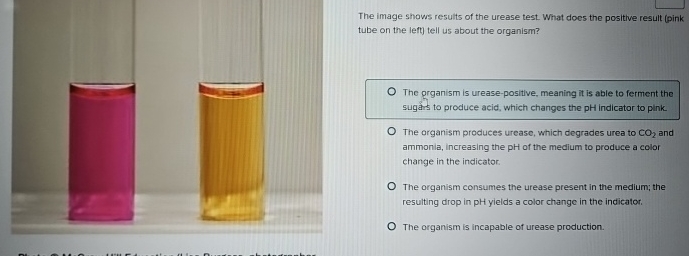 Solved The image shows results of the urease test. What does | Chegg.com