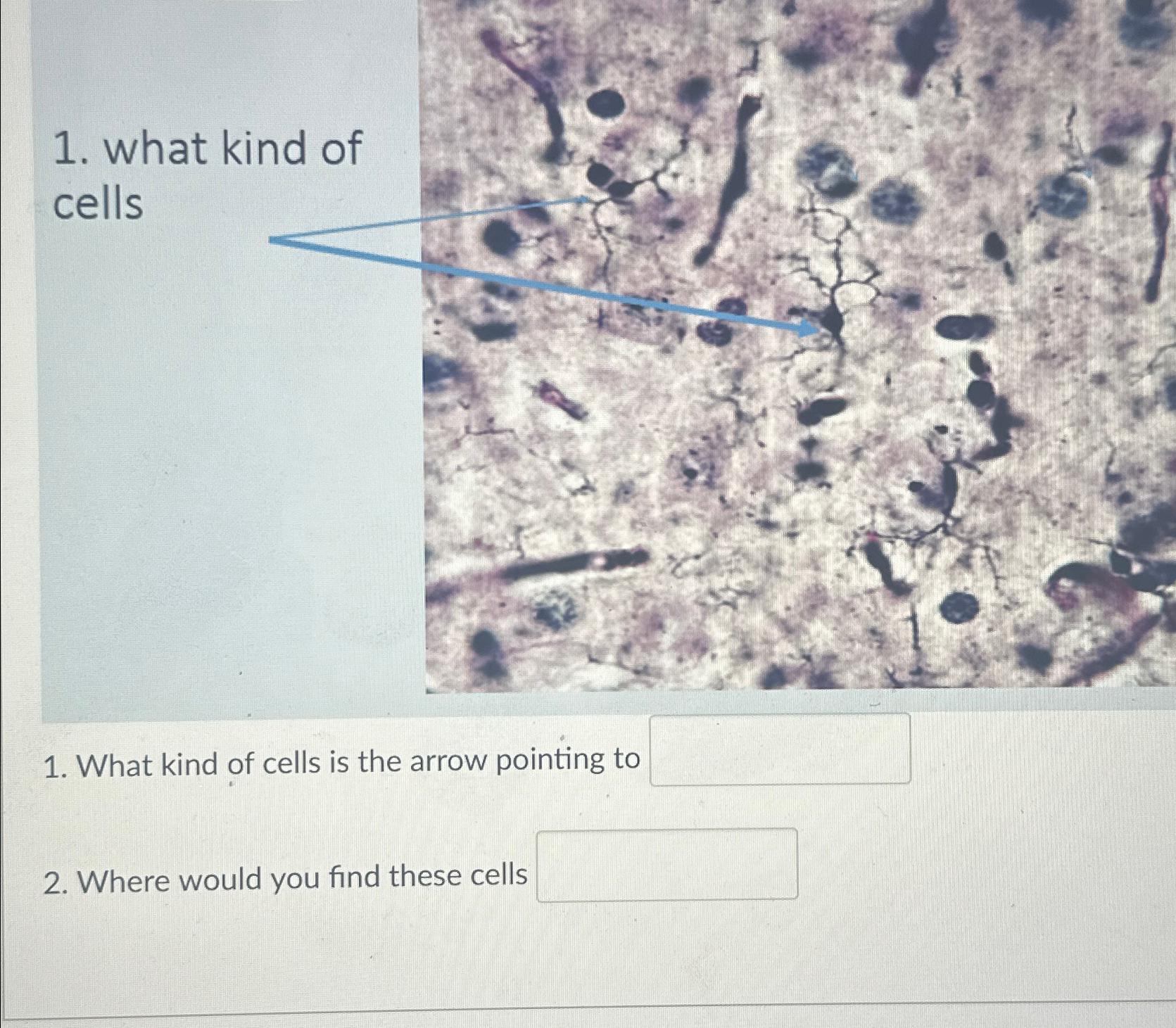 Solved what kind of cellsWhat kind of cells is the arrow | Chegg.com