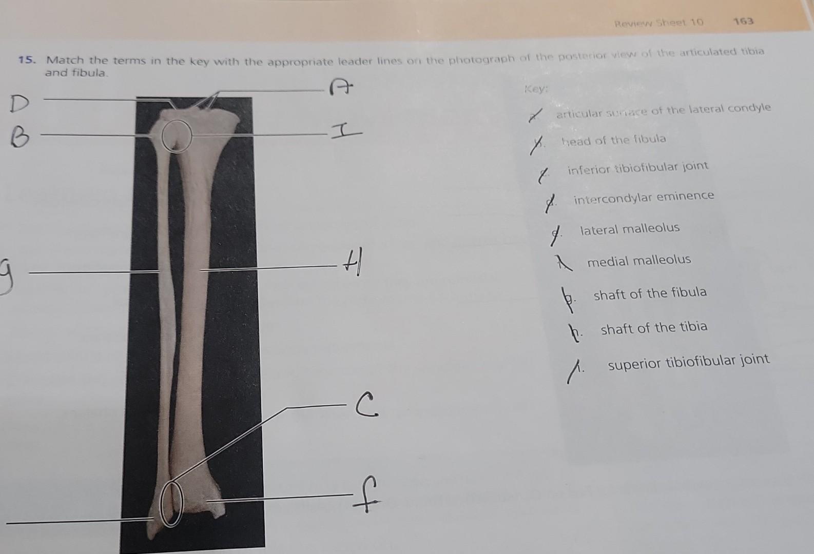 Solved 15. Match the terms in the key with the appropriate | Chegg.com