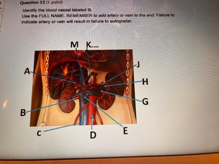 Solved Question 13 (1 point) Identify the blood vessel | Chegg.com