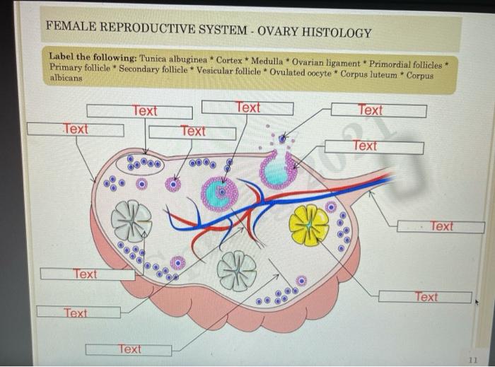 Solved FEMALE REPRODUCTIVE SYSTEM - OVARY HISTOLOGY Label | Chegg.com