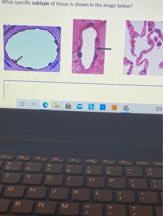 Solved wjat specific subtype of tissue is shown in tje image | Chegg.com