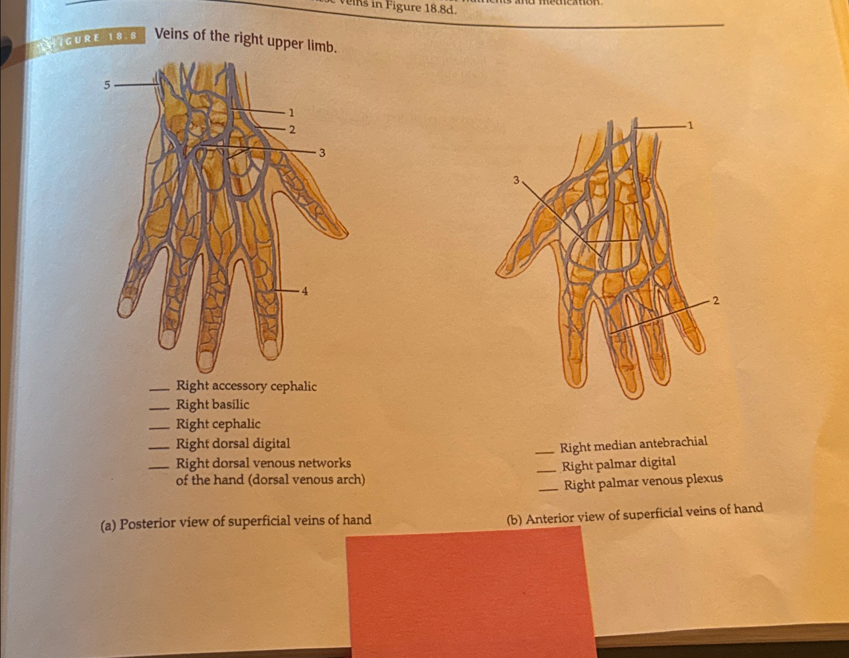 Solved CURE 18.8 ﻿Veins of the right upper limb.Figure | Chegg.com