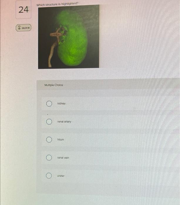 Solved Label the micrograph of the urinary bladder using the | Chegg.com