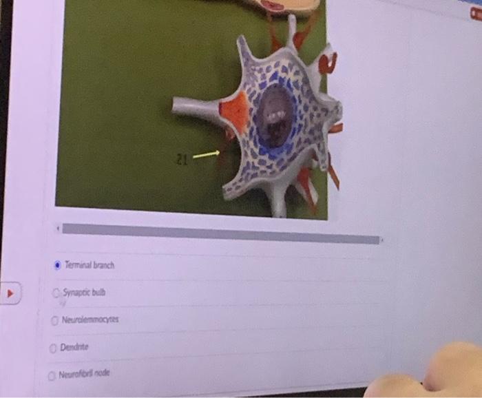 Solved 21 Terminal branch Synaptic bulb Neurdienas Dendrite | Chegg.com