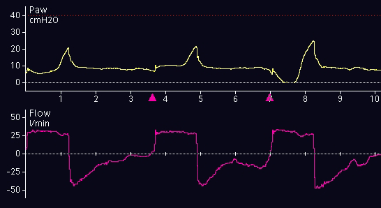 Solved Choose the type(s) ﻿of asynchrony present (select all | Chegg.com