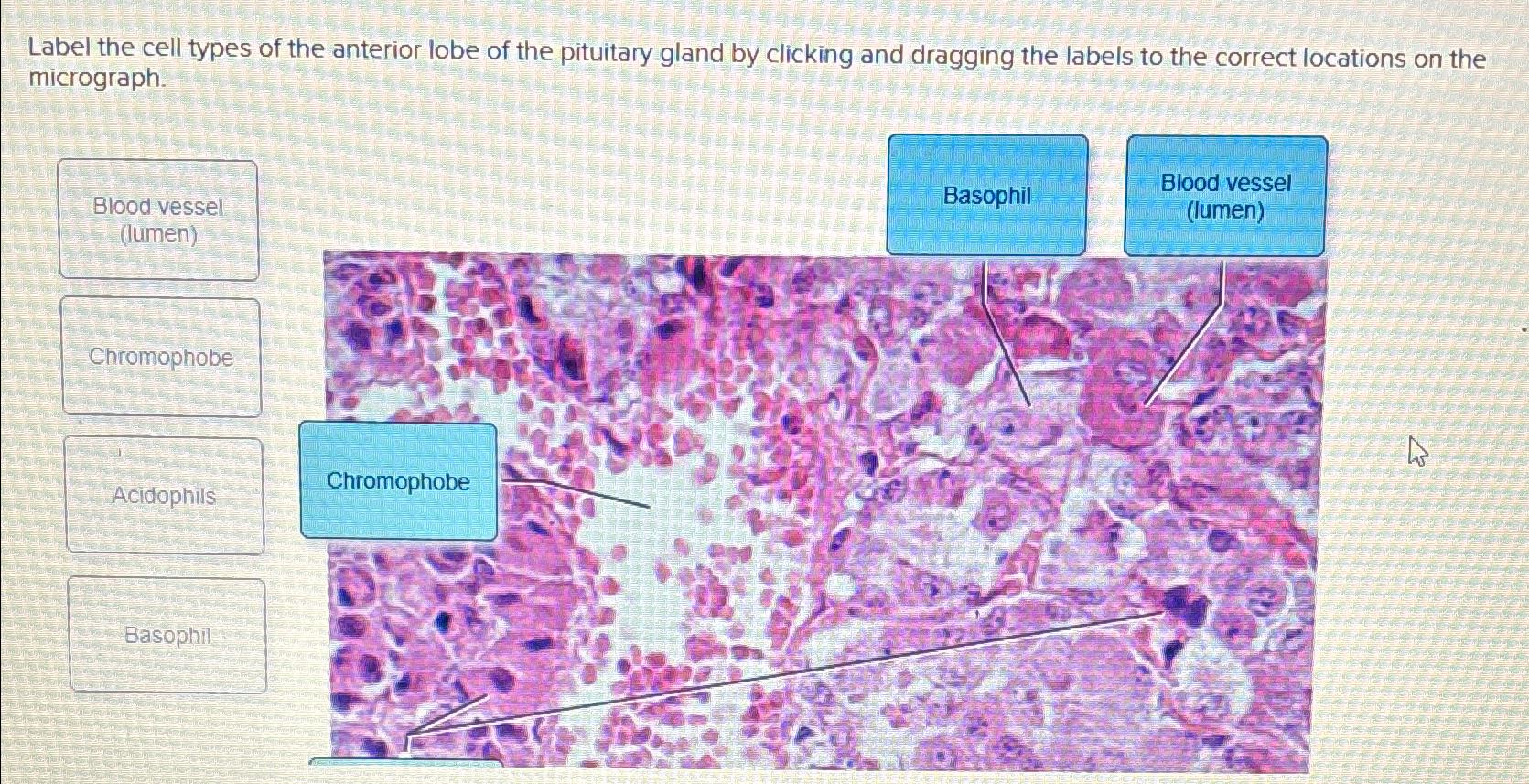 Solved Label the cell types of the anterior lobe of the | Chegg.com