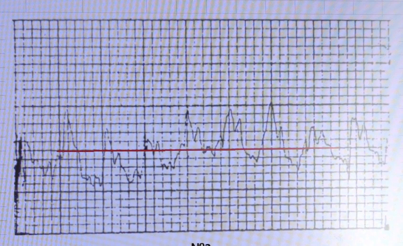 Calculate Ra,Rz,Rmax,Sm, and tp. calculate the value | Chegg.com