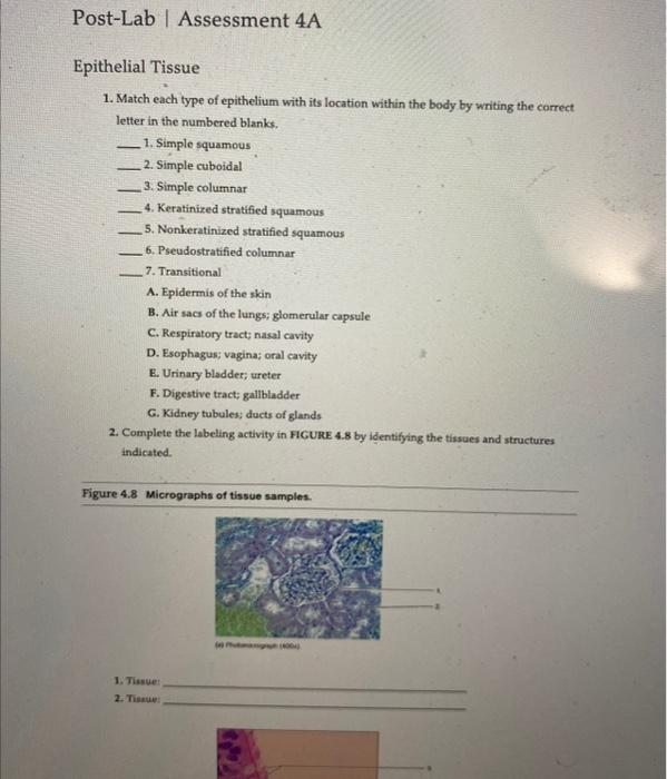 Solved Epithelial Tissue 1. Match each type of epithelium | Chegg.com Solved Epithelial Tissue 1. Match each type of epithelium | Chegg.com