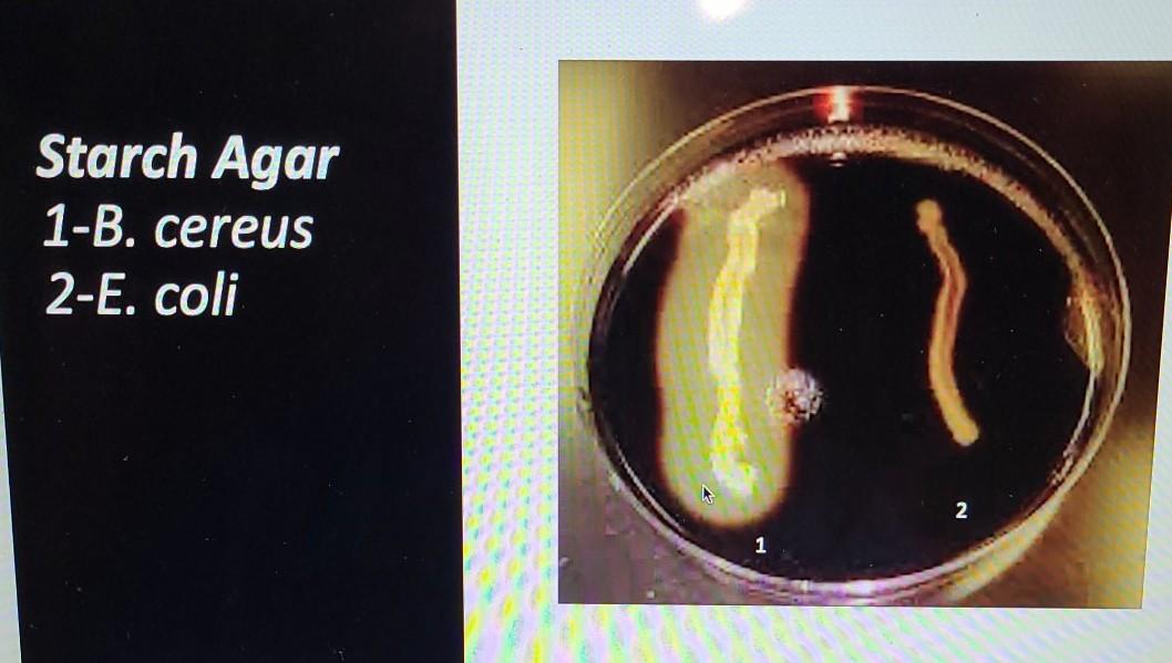 Solved Starch Agar-Looking at the results presentation | Chegg.com