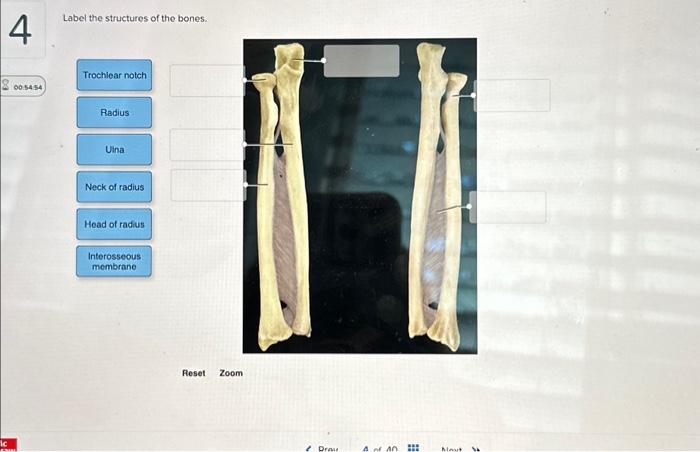 Solved Ic 4 00:54:54 Label the structures of the bones. | Chegg.com
