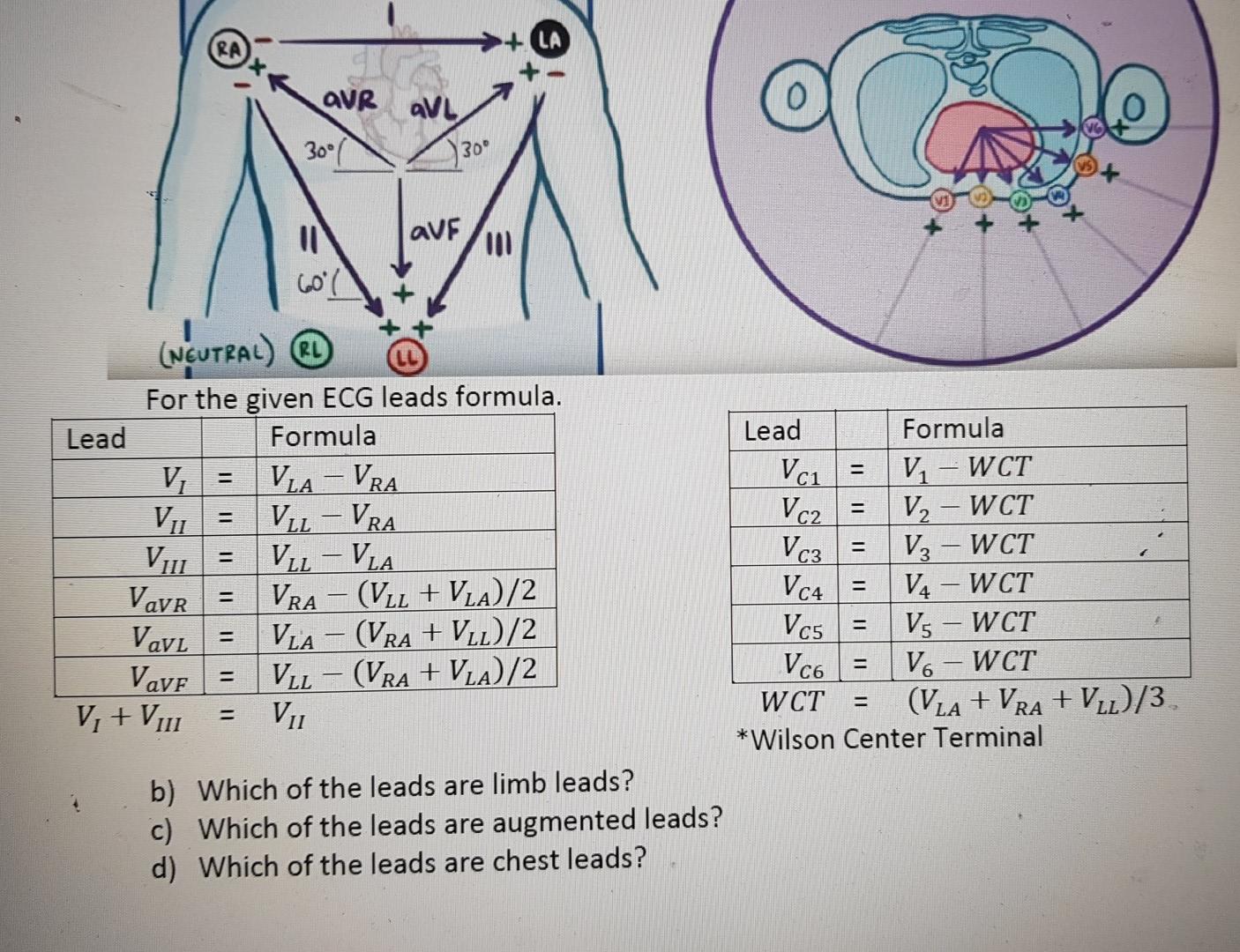Solved AVR AVL 300/ 30° aVF = = Vu Vc3 = = (NEUTRAL) R For | Chegg.com