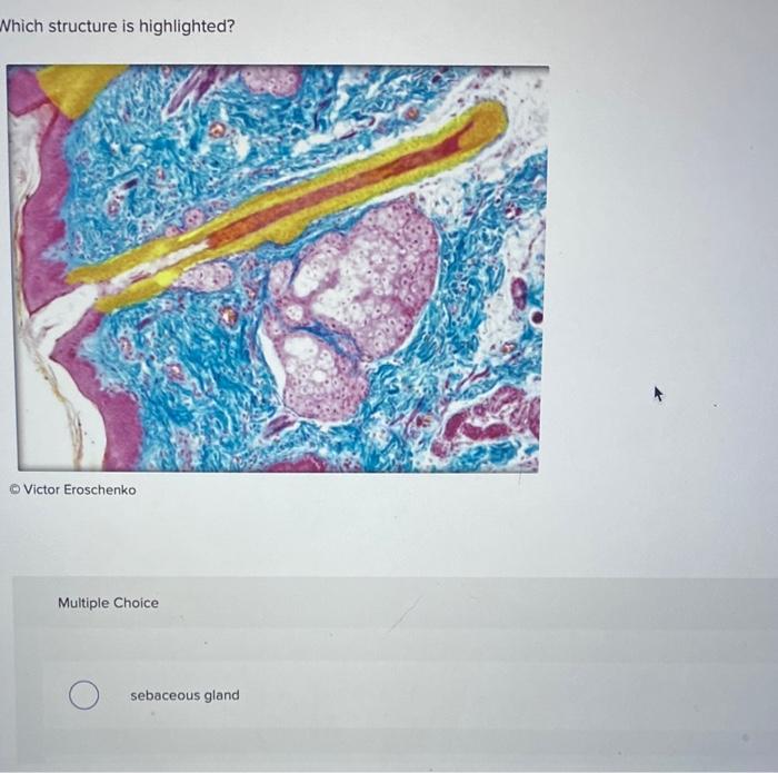 [Solved]: Which structure is highlighted? Multiple Choice s