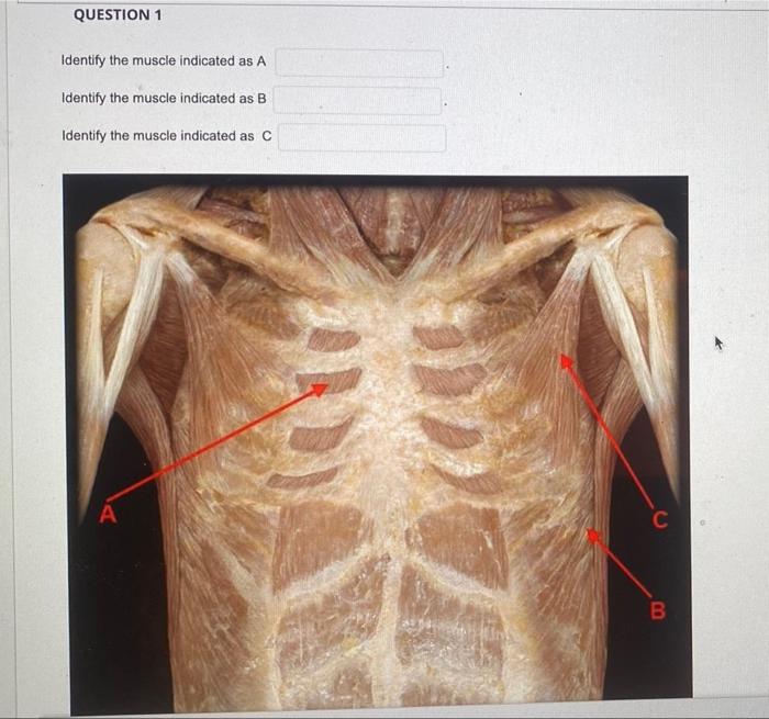 Solved QUESTION 1 Identify the muscle indicated as A | Chegg.com