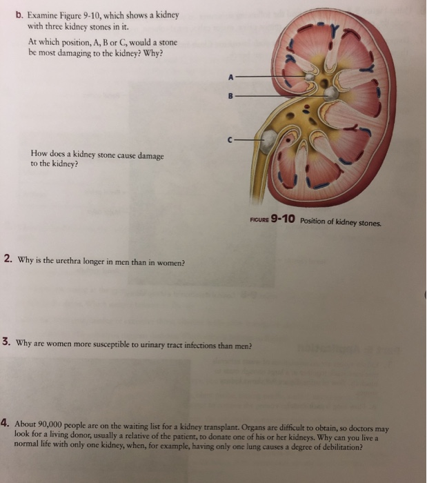 Solved Renal medulla FIGURE 9-8 Coronal dissection of a | Chegg.com