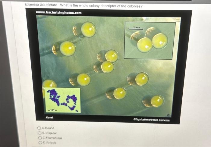 Solved Examine this picture. What is the whole colony | Chegg.com