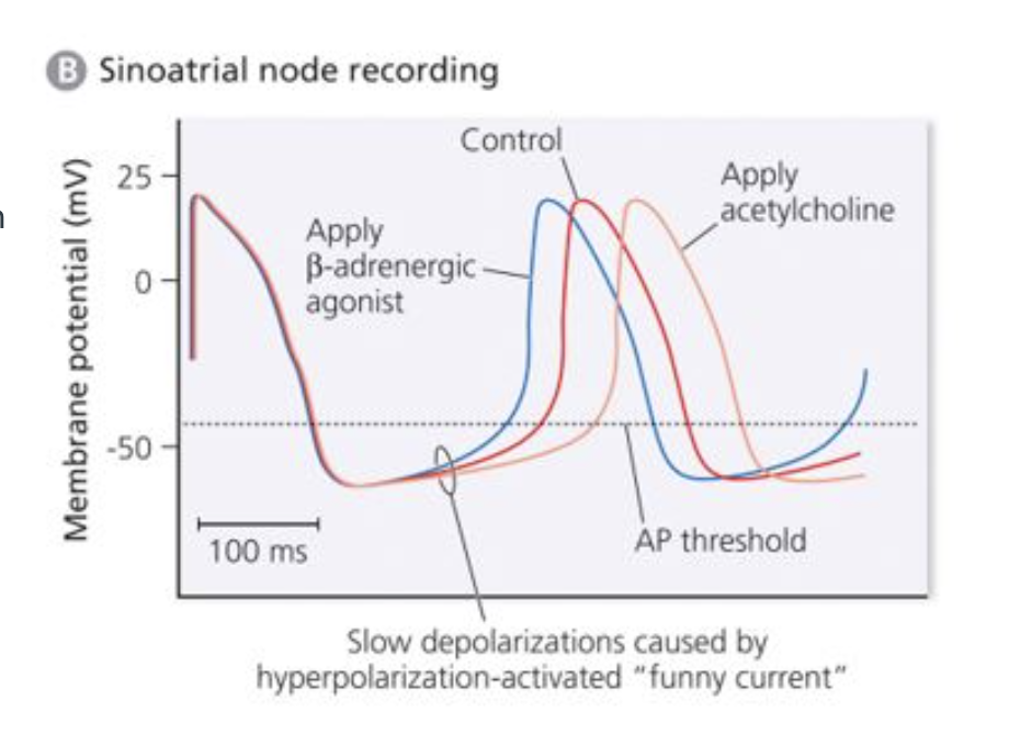 Solved B Sinoatrial node recording Which of the following | Chegg.com
