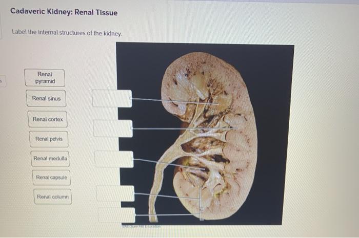 Solved Cadaveric Kidney: Renal Tissue Label the internal | Chegg.com