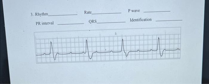 Solved PR interval QRS Identification | Chegg.com