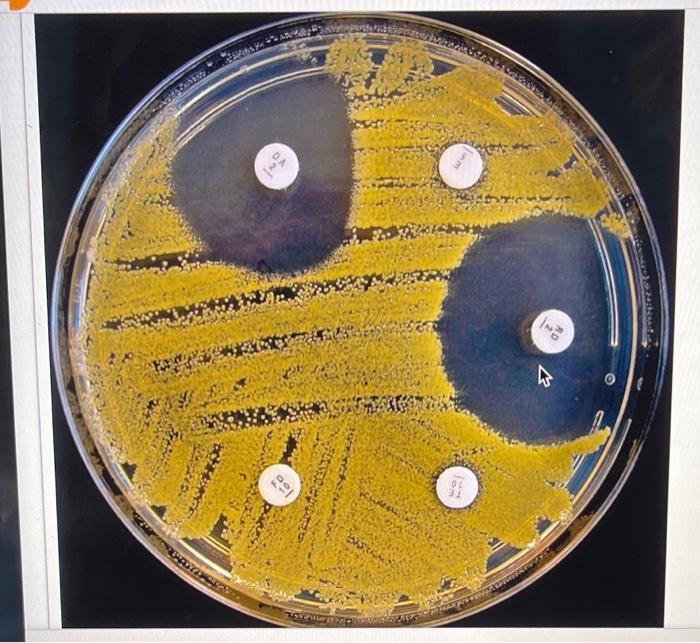 Solved QUESTION 6 What is a positive result of the Urease | Chegg.com
