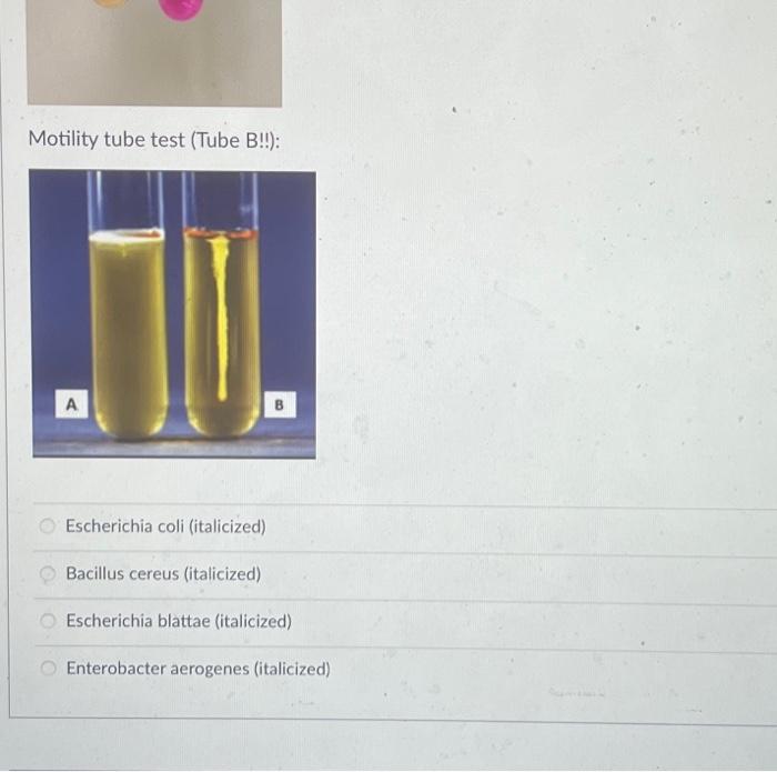 Enterobacter Aerogenes Motility Test