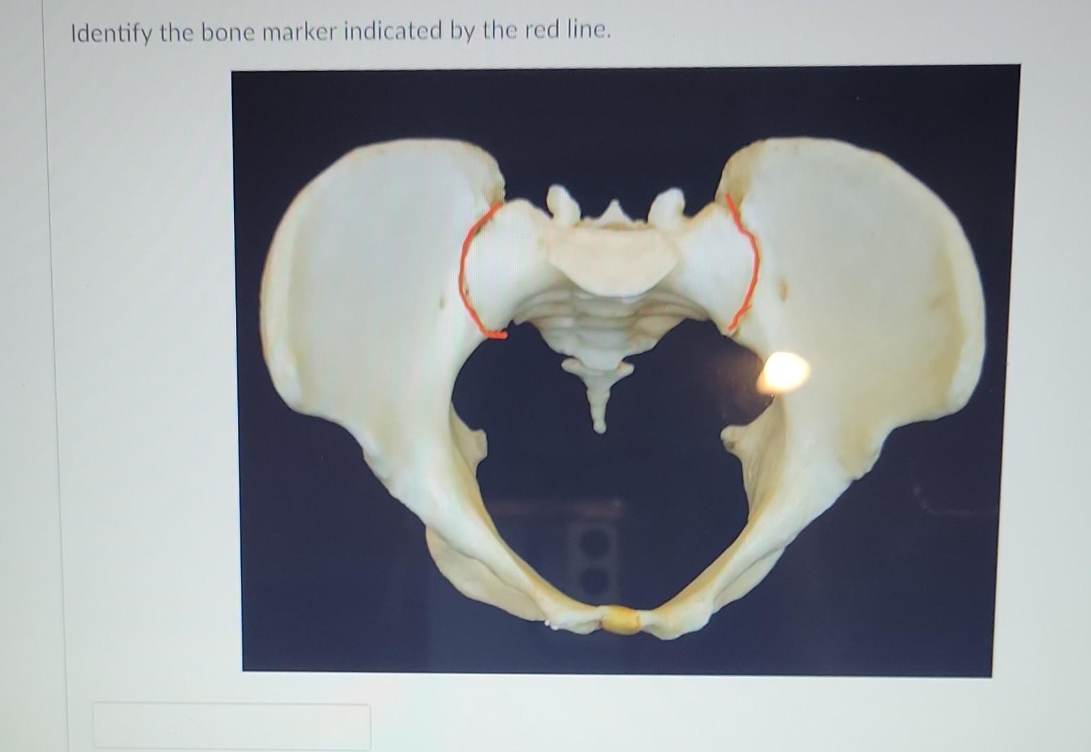 Solved Identify the bone marker indicated by the red | Chegg.com