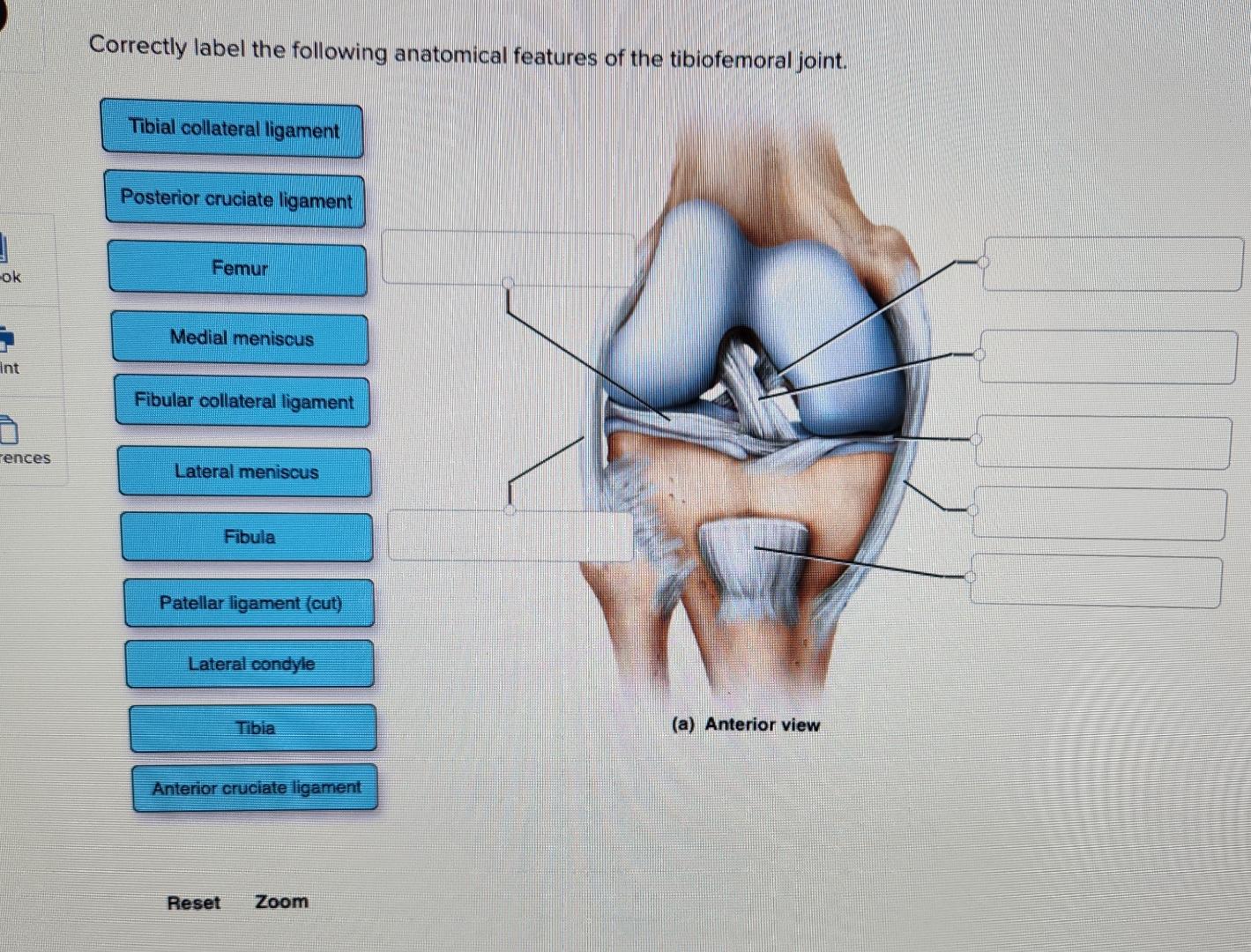 Solved Correctly label the following anatomical features of | Chegg.com