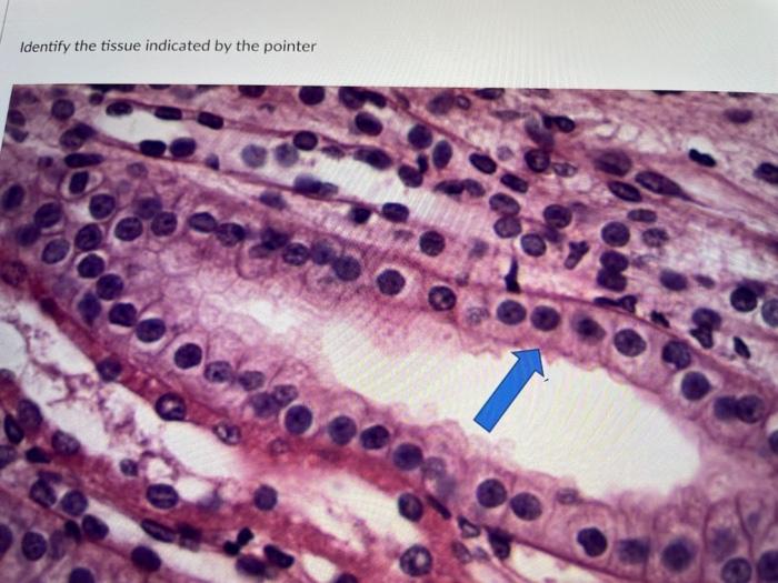 Solved Identify the tissue presented in this image | Chegg.com