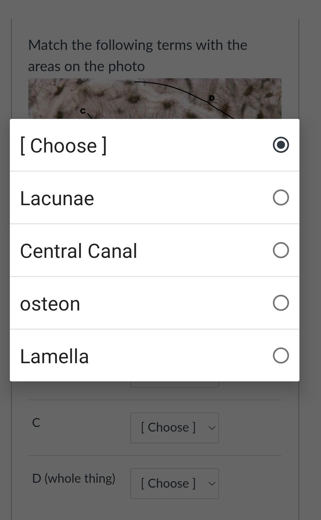 Solved Match the following bone structures to the bones. | Chegg.com