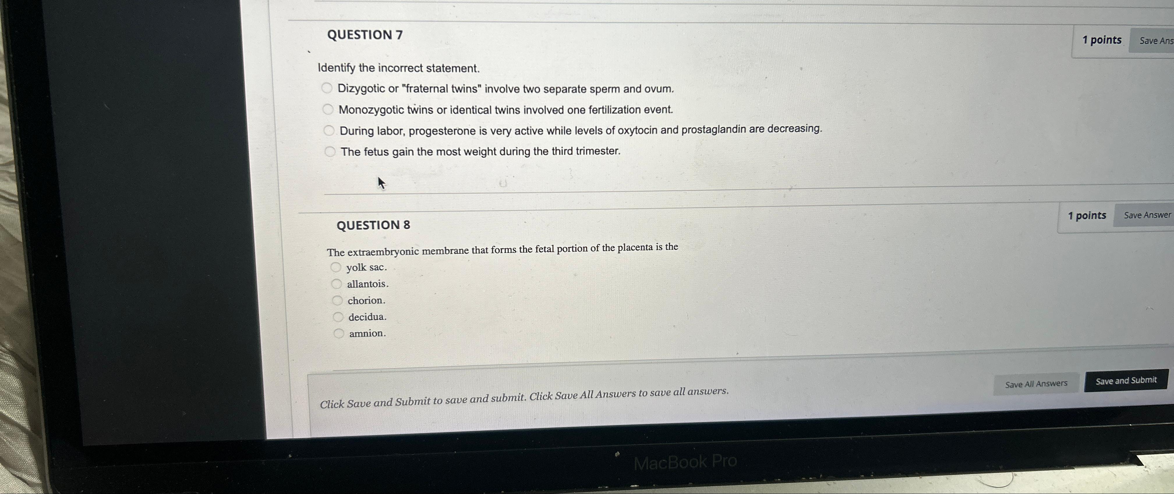 Solved QUESTION 71 ﻿pointsIdentify the incorrect | Chegg.com
