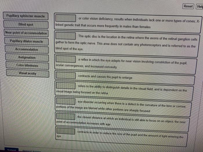 Solved Define the following terms associated with visual | Chegg.com