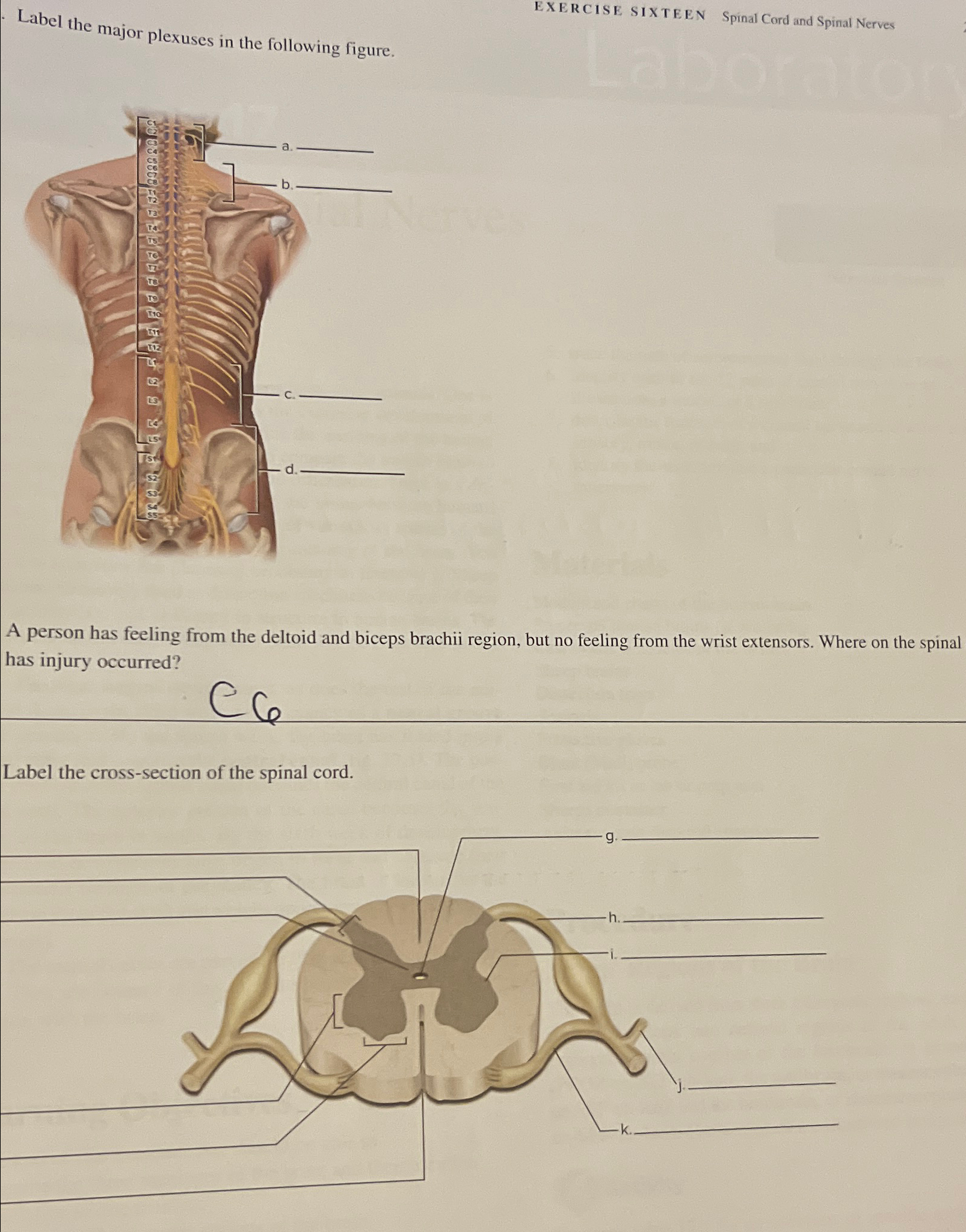 Solved Spinal Cord and Spinal NervesEXERCISE SIXTEEN Spinal | Chegg.com