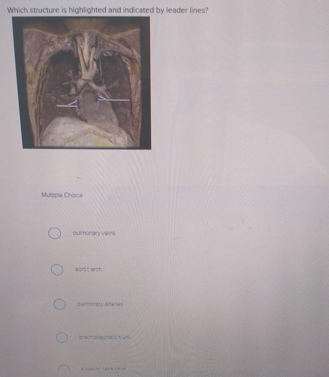 Solved Which structure is highlighted and indicated by | Chegg.com