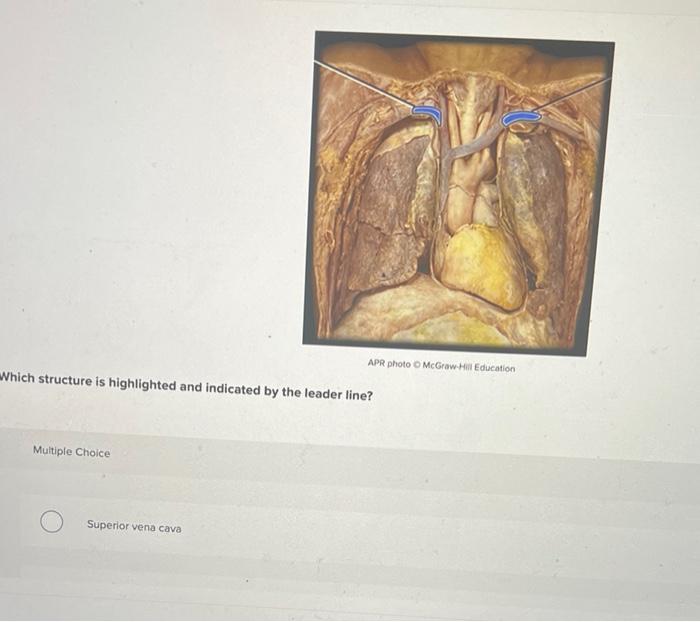 Solved APk photo O McGraw.Hill Education Which structure is | Chegg.com