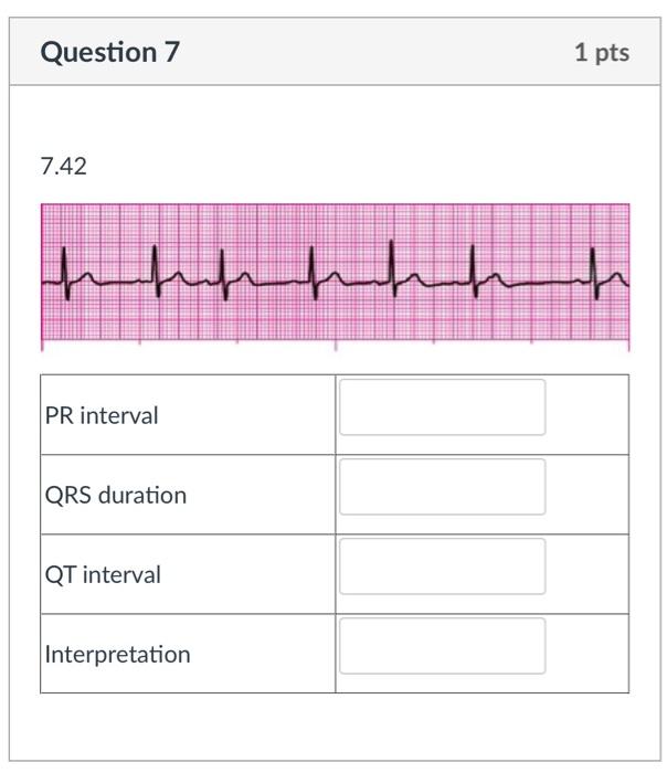 Solved Question 7 1 pts 7.42 PR interval QRS duration QT | Chegg.com