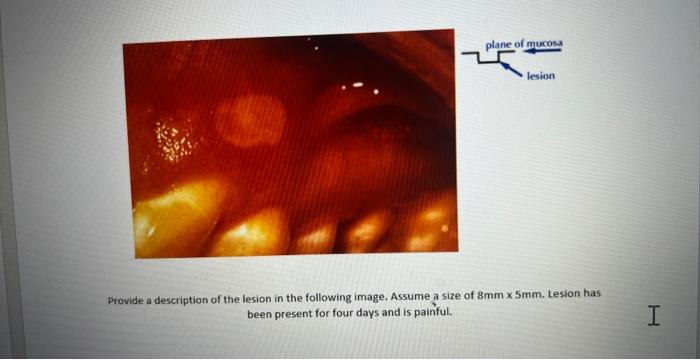 Solved Provide a description of the lesion in the following | Chegg.com