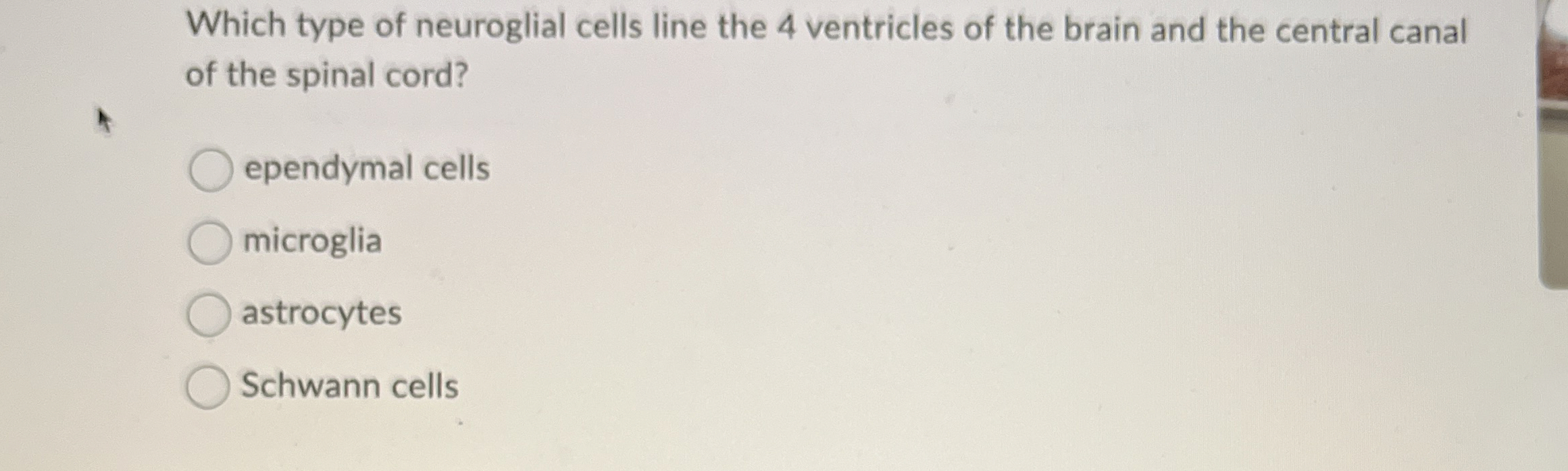 Solved Which type of neuroglial cells line the 4 ﻿ventricles | Chegg.com