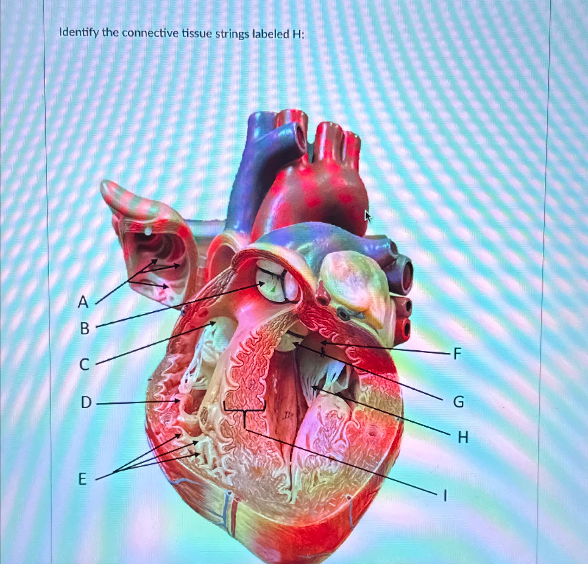 Solved Identify the connective tissue strings labeled H ﻿: | Chegg.com