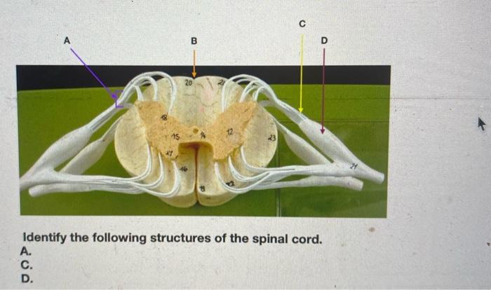 Solved Identify the following structures of the spinal cord. | Chegg.com
