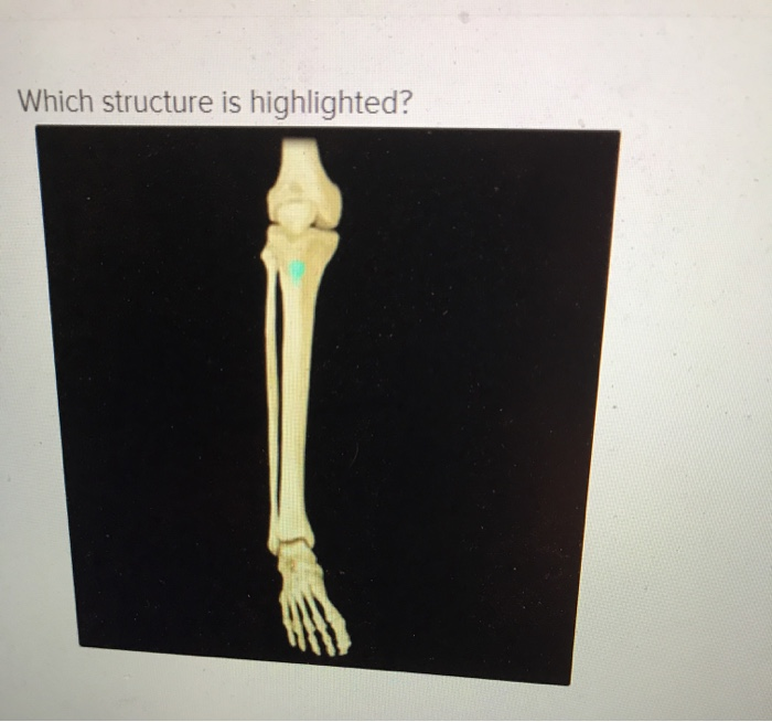 Solved Which structure is highlighted? 10 Multiple Choice | Chegg.com