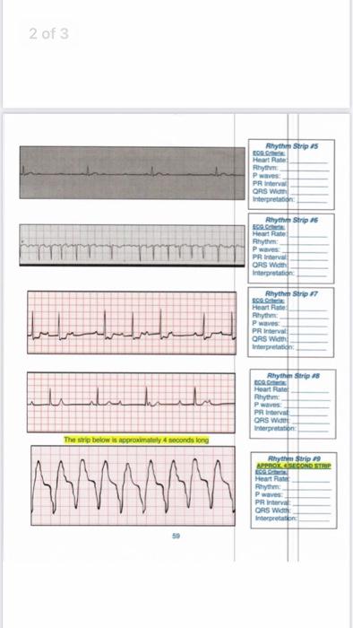 Practice Rhythm Strips The following rhythm strips | Chegg.com
