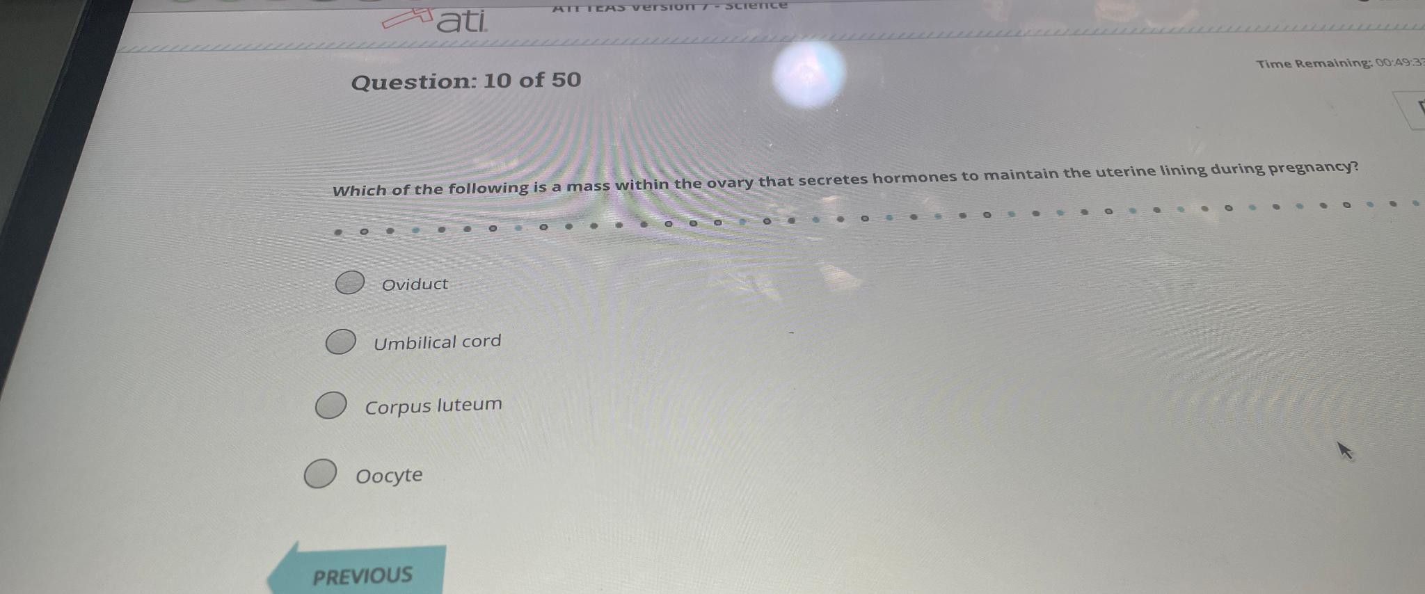 Solved Question: 10 of 50Which of the following is a mass | Chegg.com Solved Question: 10 of 50Which of the following is a mass | Chegg.com