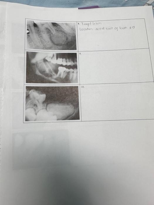describe the apperance and location of the lesion or | Chegg.com