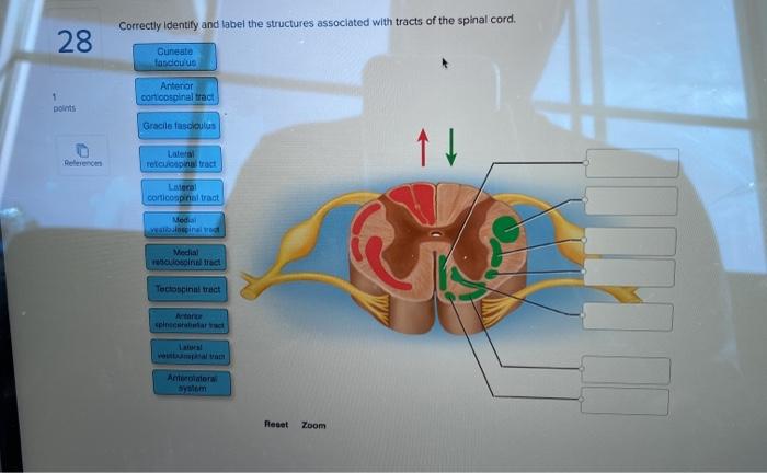 Solved Correctly identify and label the structures | Chegg.com