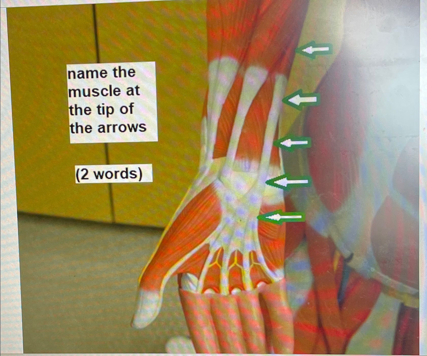 Solved name the muscle at the tip of the arrows | Chegg.com