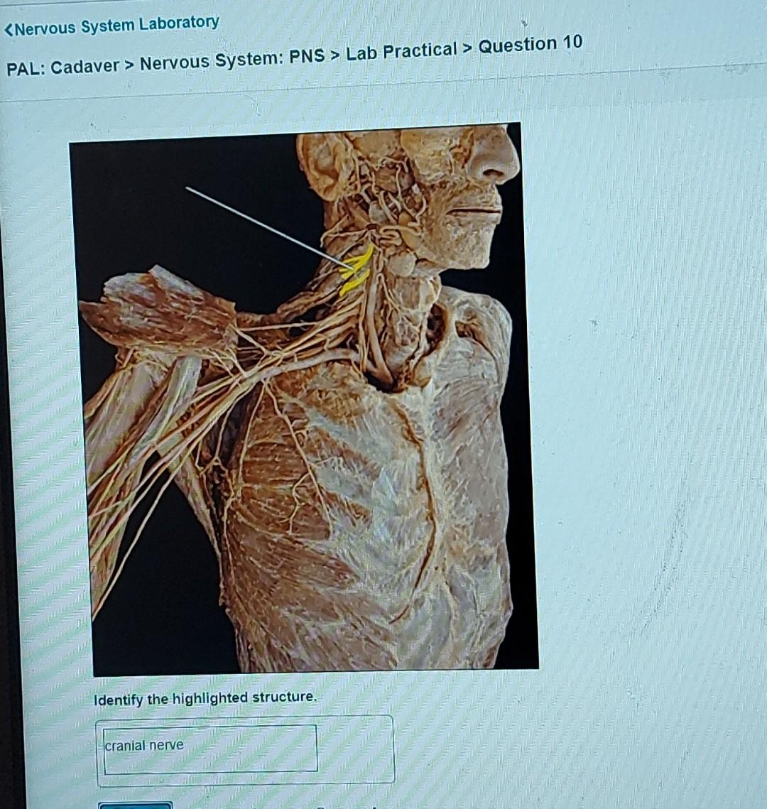 Solved Nervous System: PNS > Lab Practical > Question 10 | Chegg.com