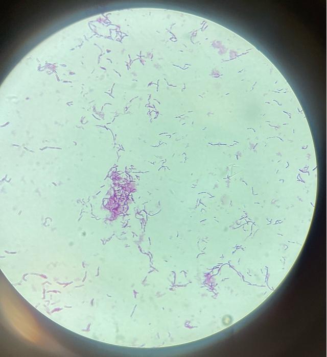 Solved Question 3: When you summarize the results of an | Chegg.com